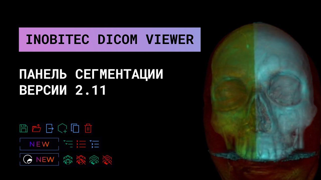 Панель сегментации в Inobitec DICOM Viewer