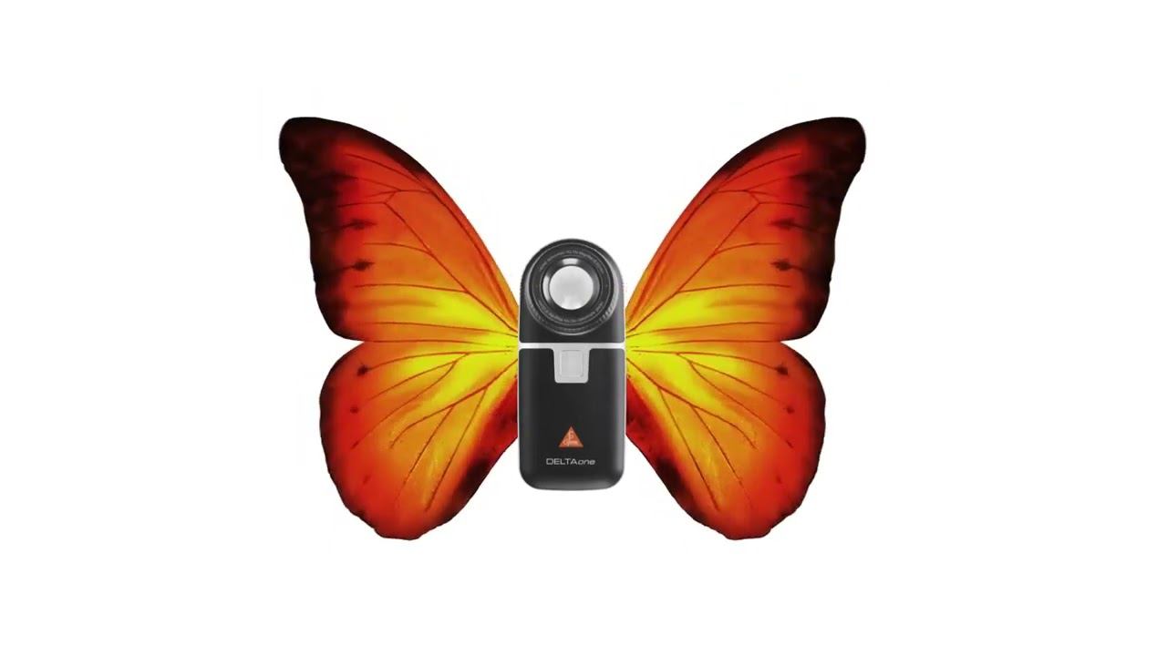 HEINE DELTAone Dermatoscope — Teaser