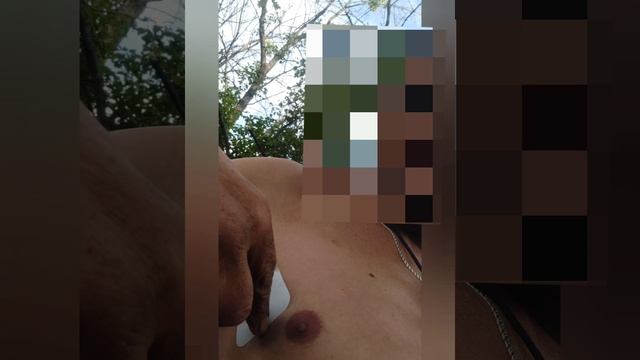 Лёгкое ранения,спас броник.июль 2023