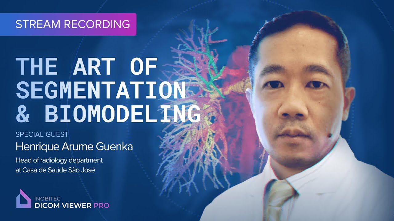 Inobitec DICOM Viewer Pro: Искусство сегментации и биомоделирования
