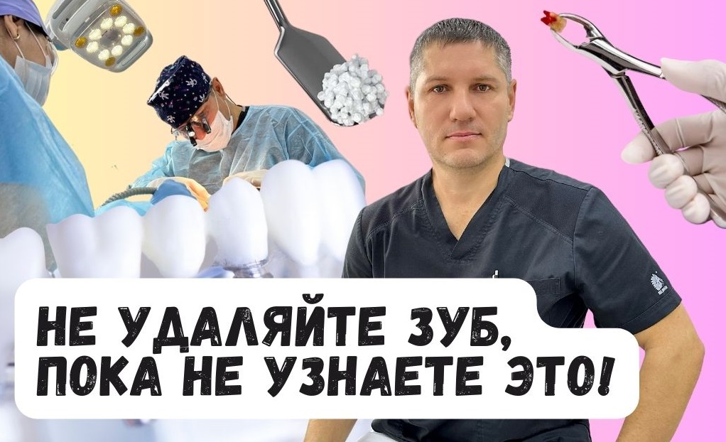 НЕ УДАЛЯЙ ЗУБ, пока не узнаешь ЭТО