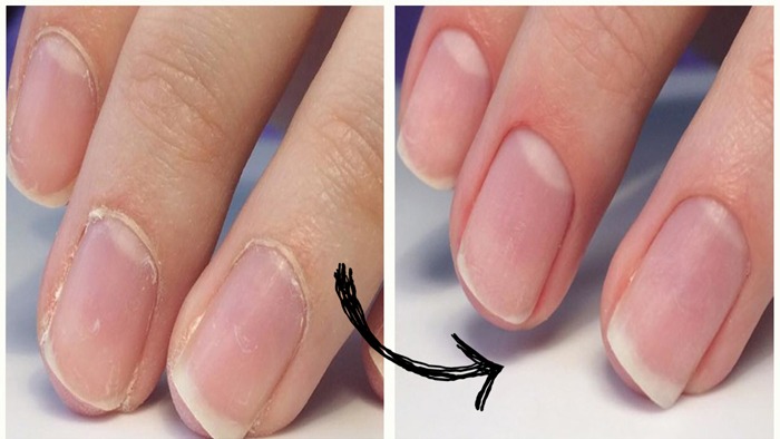 Как удалить кутикулу без ножниц, щипчиков и ремувера Необрезной маникюр в домашних условиях 