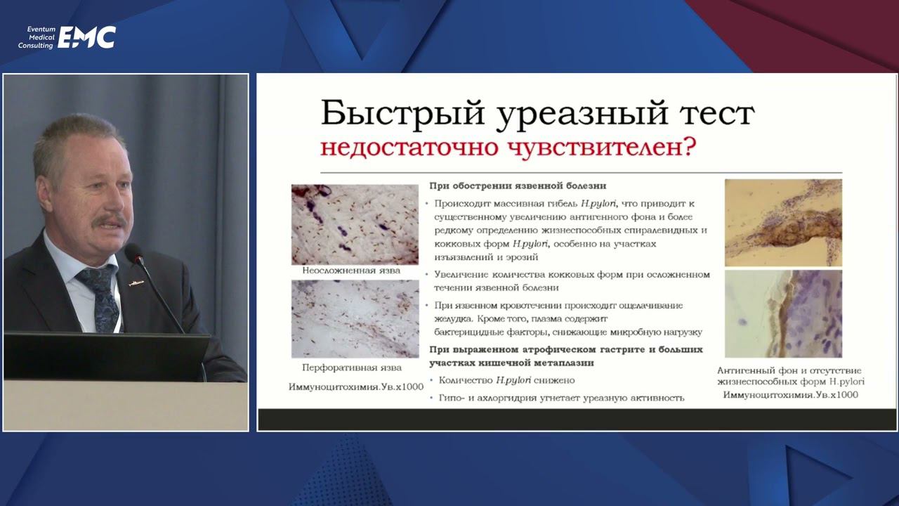 02   Быстрый уреазный тест: забыть нельзя использовать. Назаров Виталий Евгеньевич