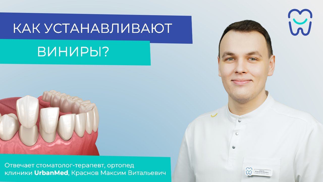 Как устанавливают виниры?