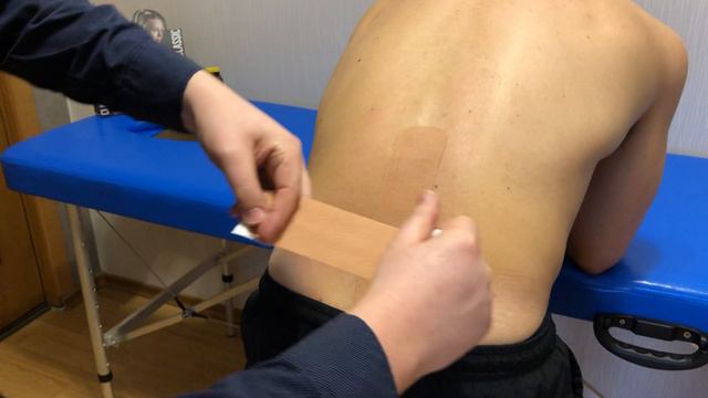 Наложение кинезио тейпа при грыже или протрузии межпозвоночного диска