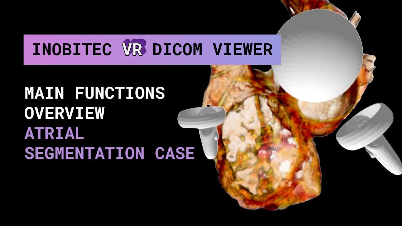 Обзор функциональности программы Inobitec VR DICOM Viewer на примере сегментации предсердий.