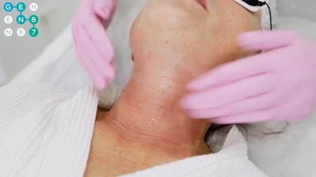 ЛАЗЕРНАЯ ШЛИФОВКА ЛИЦА И ТЕЛА NANOPIXEL CO2 Сеть клиник косметологии GEN87