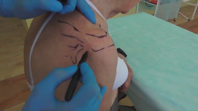 #Плечо #Артрит #Диагностика