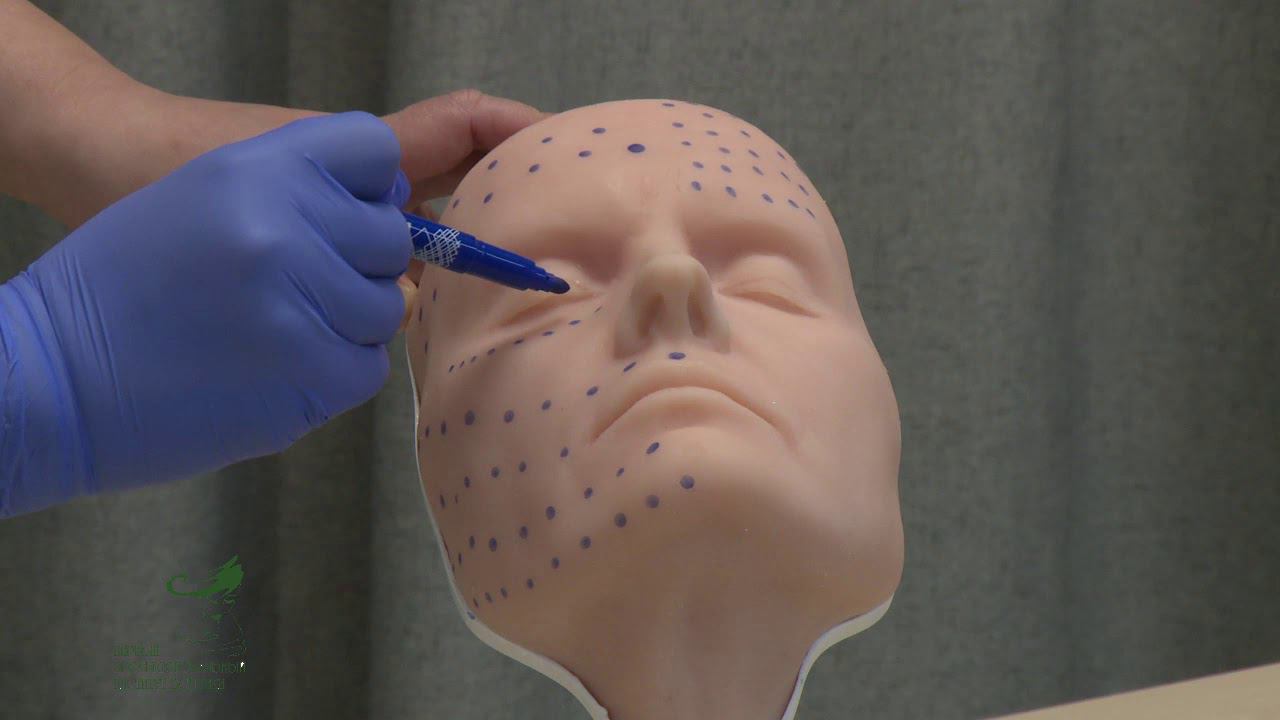 Практическое занятие Мезотерапия лица  Отработка на манекене