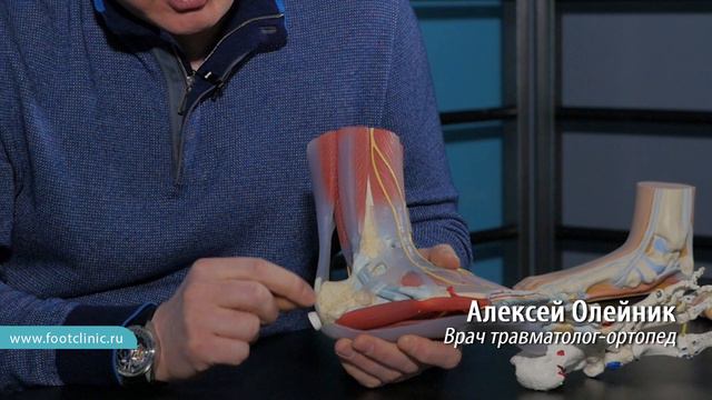 ДЕФОРМАЦИЯ ХАГЛУНДА ЛЕЧЕНИЕ операция или консервативное лечение? доктор Алексей Олейник #footclinic
