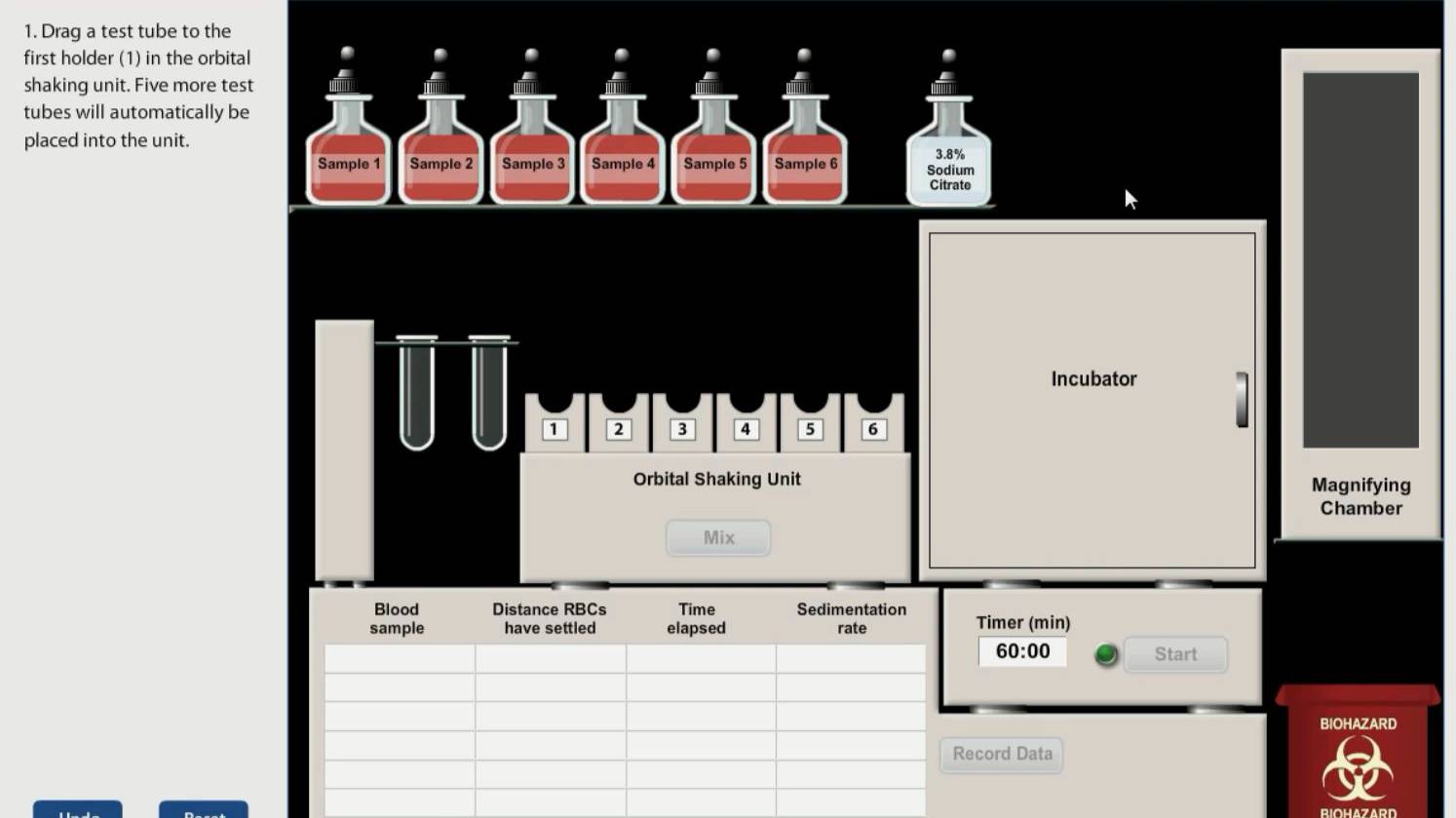 Определение СОЭ (скорость оседания эритроцитов). 3 семестр. Тема 3. Работа 1.