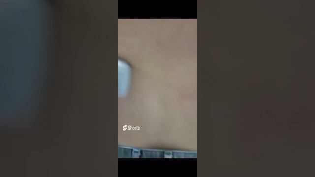 Скэнар аппарат [ мой личный опыт ]. Честный отзыв.