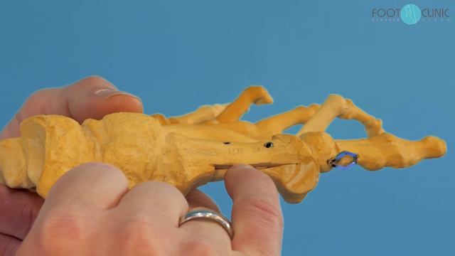 Пример операции SCARF с объяснениями