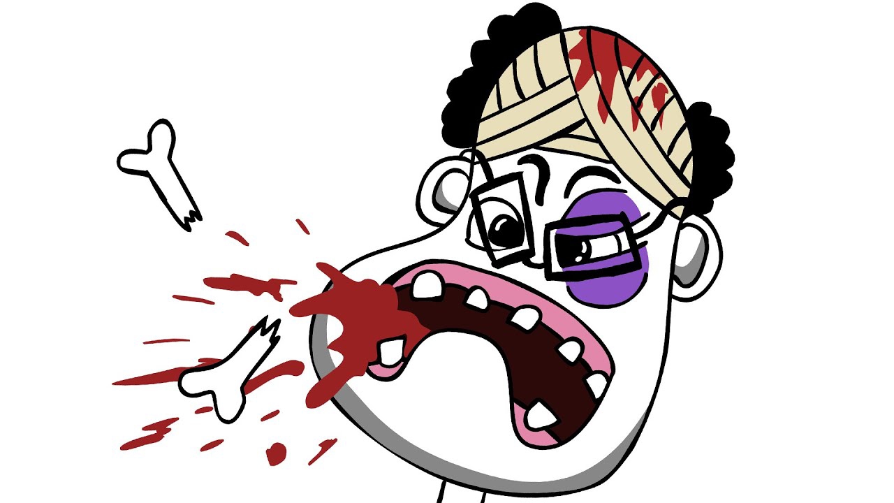 КАК МОЕМУ ДРУГУ СЛОМАЛИ ЧЕЛЮСТЬ