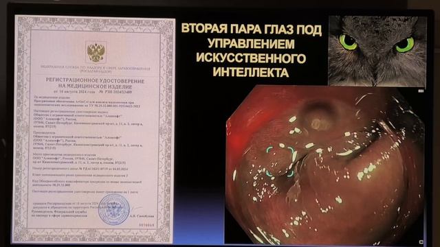 2024 09 18 01 Федоров ЕД Эндоскопические технологии в диагностике новообразований и предраковых забо