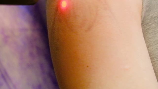 Отзывы о лазере MAGIC_SUPER_FULL