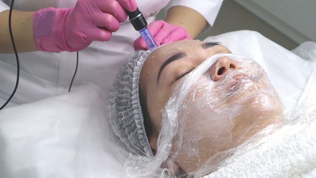 Микронидлинг