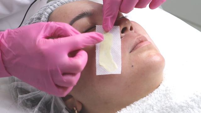 Эстетическая коррекция волосяного покрова лица, шеи и зоны декольте различными способами