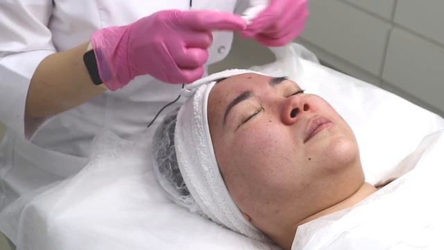 Механическая чистка лица