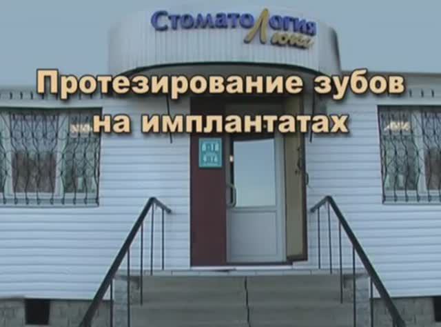 Протезирование зубов на имплантатах в стоматологической клинике "Люкс", г.Абакан