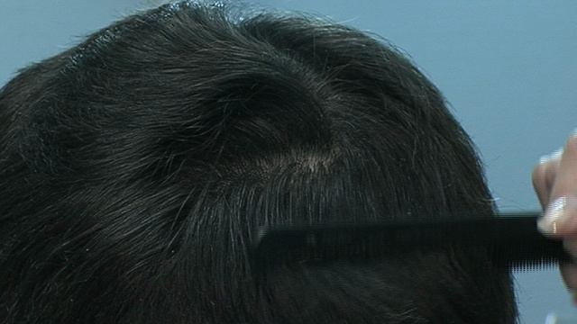 Облысение// 27.12.2008г.