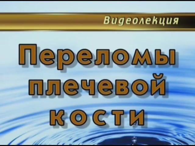 Переломы плечевой кости (инновационные технологии остеосинтеза)