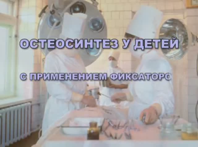Остеосинтез у детей с применением фиксаторов с памятью формы