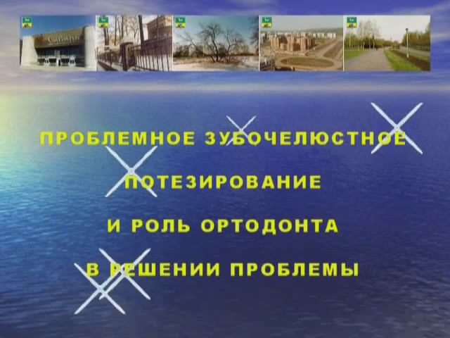 Проблемное зубочелюстное протезирование и роль ортодонта в решении проблемы