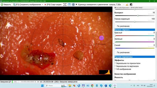 2024-09-10_145244-работа в окне видеозахват, ч. 2 и Настройка камеры в ПО Дианел®-Микро Кольпоскопия