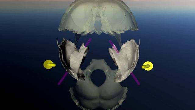 Височные кости. Видео 3