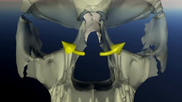 Носовые кости. Дисфункция