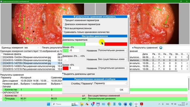 2024-09-11_141242-Сравнительный анализ области патологии ШМ ПО Дианел®-Микро Кольпоскопия