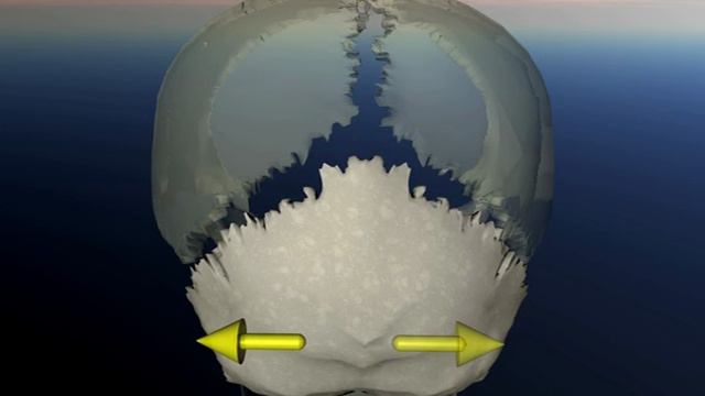 Затылочная кость. Дисфункция