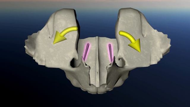 Верхняя челюсть. Дисфункция