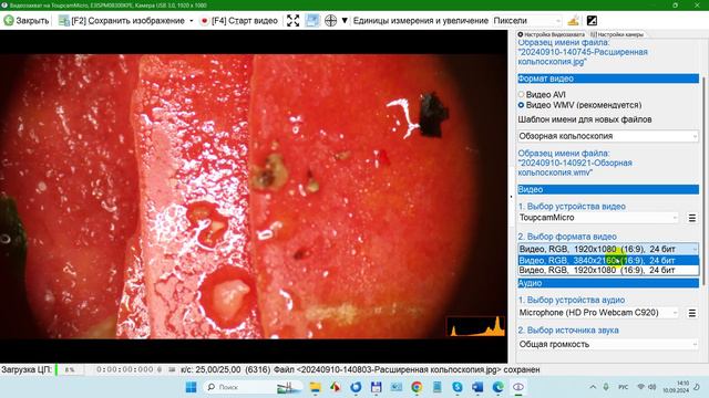 2024-09-10_141909-работа в окне Видеозахват, ч. 1, выбор Кольпоскопической сетки в ПО Дианел®-Микро