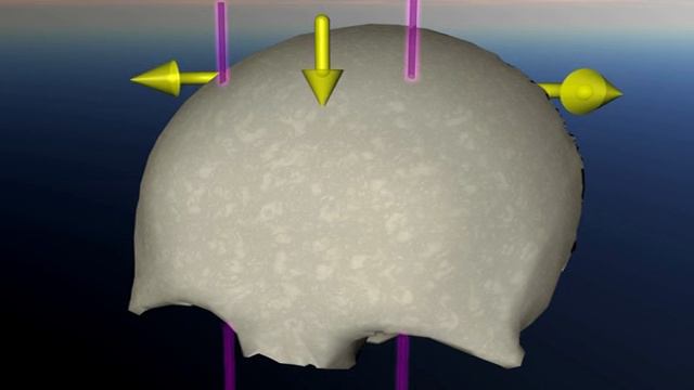 Лобная кость. Видео 1