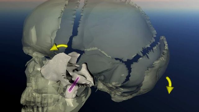 Клиновидная кость. Видео 1