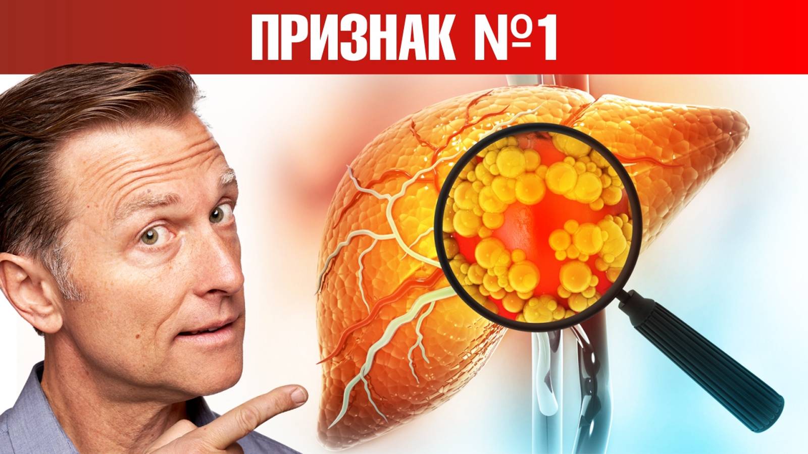 Симптом №1 того, что у вас жирная печень🙌