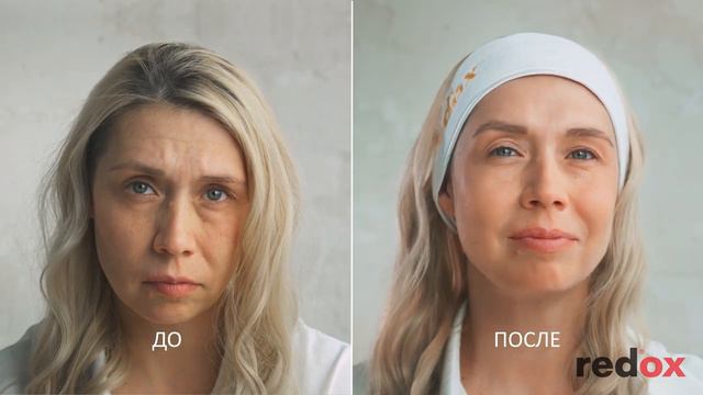 До и после - альгинатные маски redox