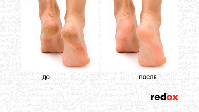 Носки redox (до и после)