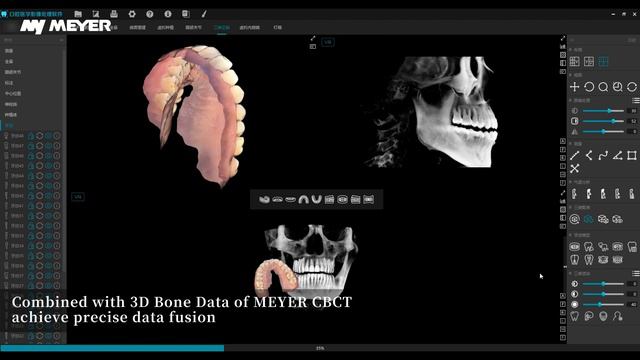 Интраоральный сканер Meyer MyScan3