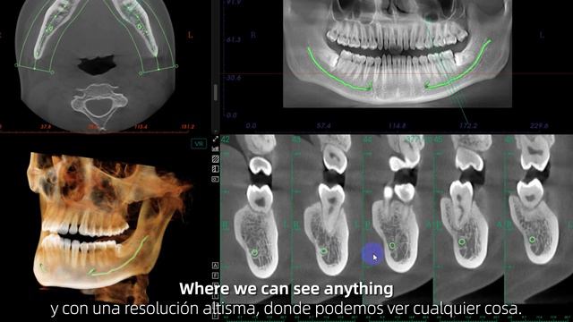 Meyer - Clinica Dental Moreno