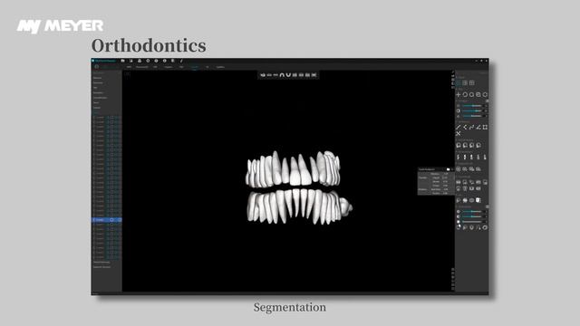 Meyer CBCT - стоматологический томограф
