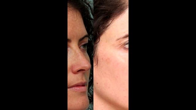 Яблоко – избавит от пигментных пятен!#Shorts