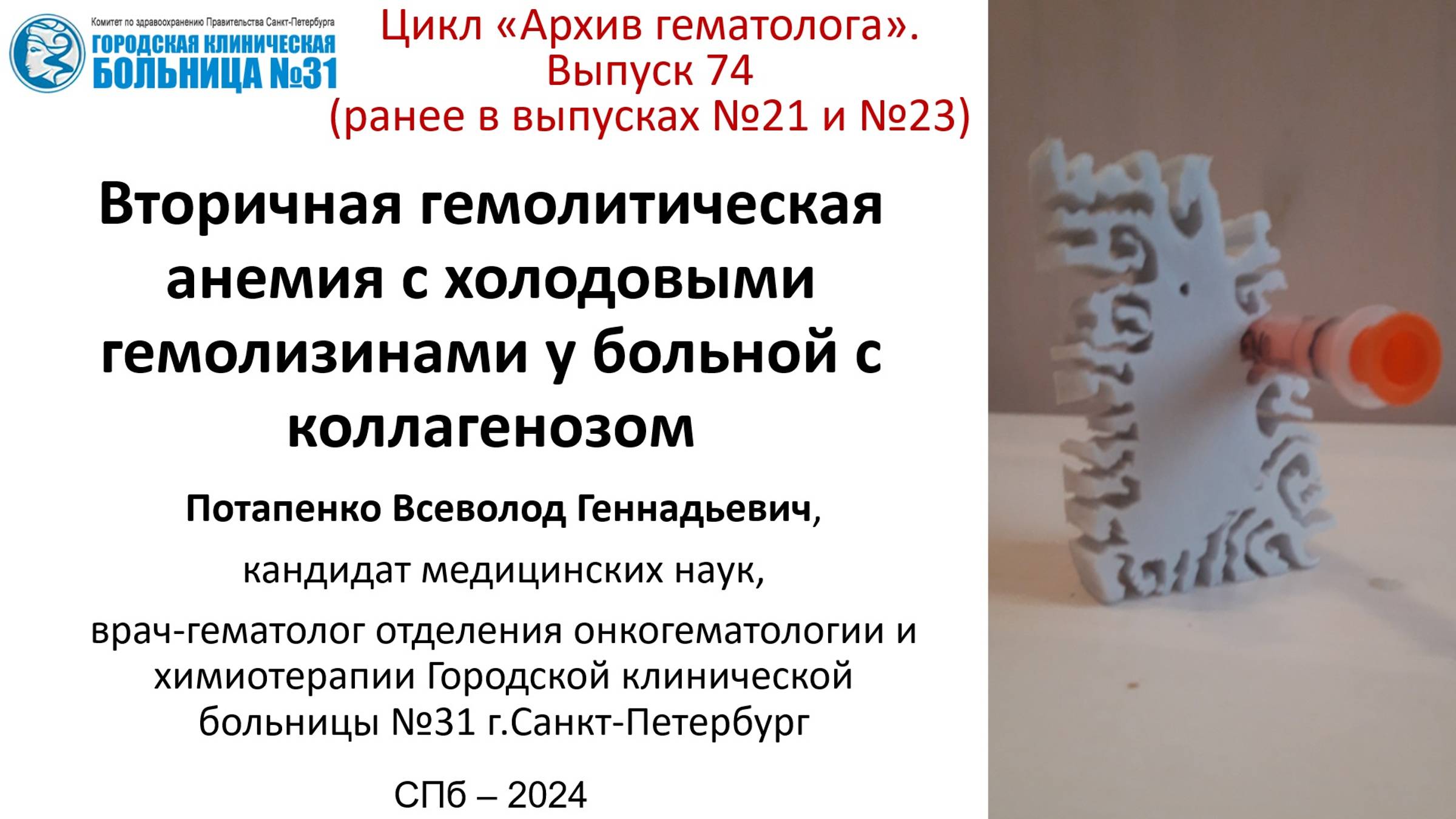 Архив гематолога 74. Холодовая гемолитическая анемия тяжелой степени при коллагенозе