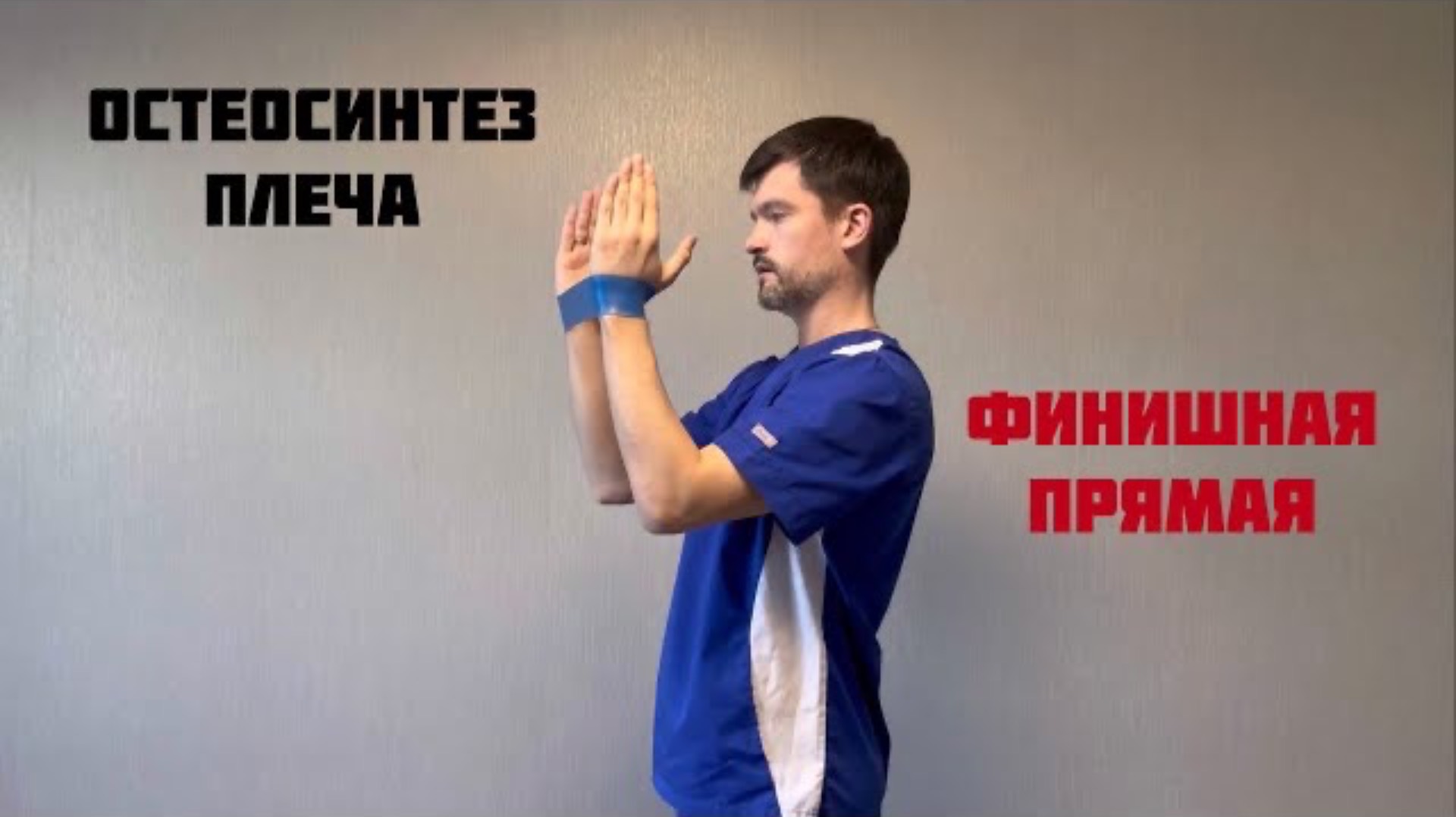 Остеосинтез плеча. Упражнения после повторного снимка