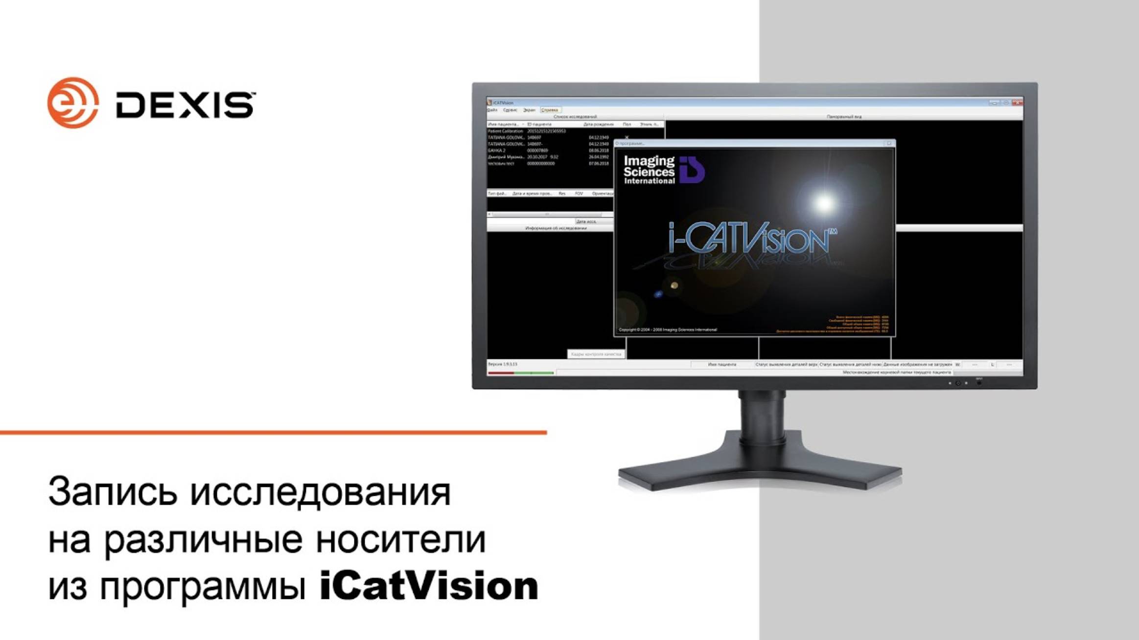 Запись исследования на различные носители из программы iCatVision