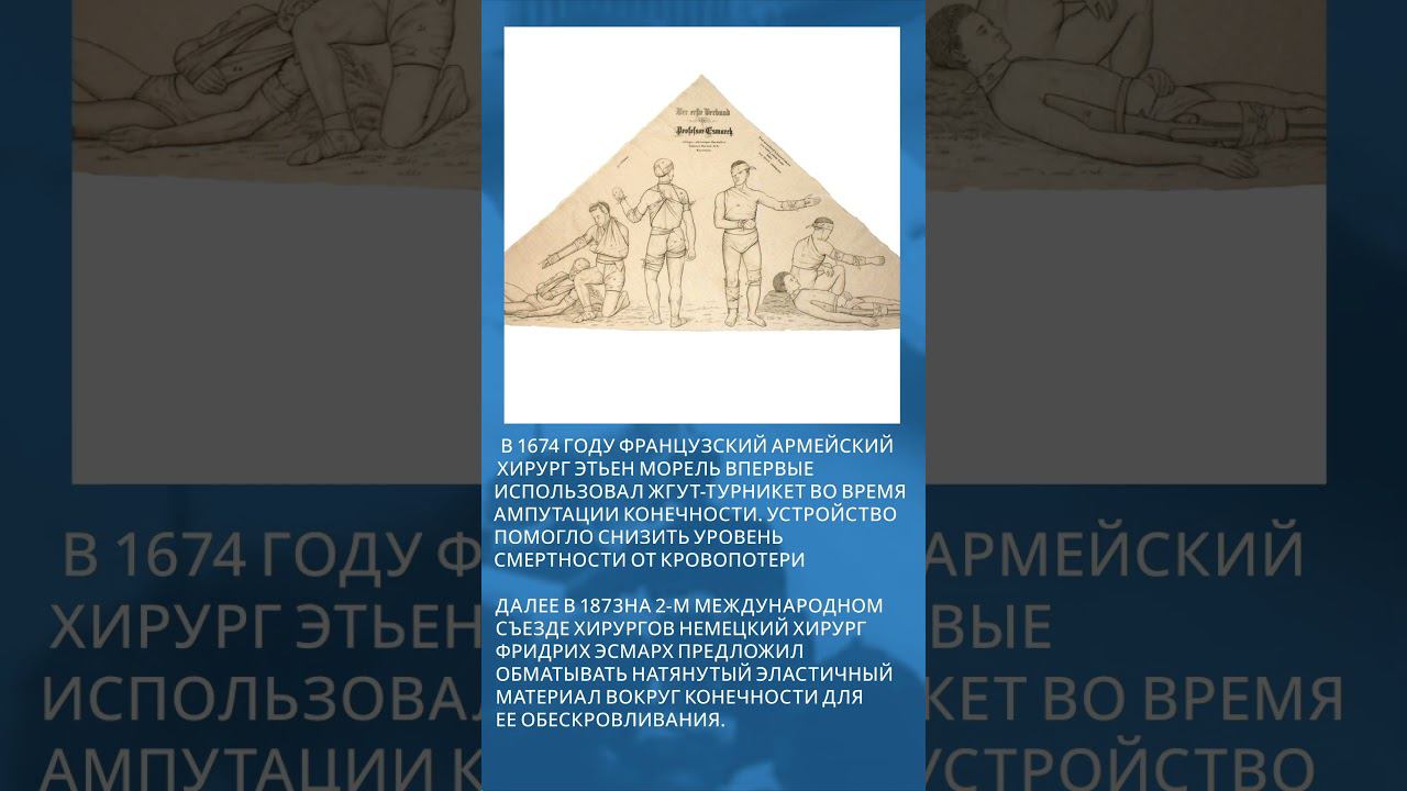 К 100-летию применения кровоостанавливающего жгута