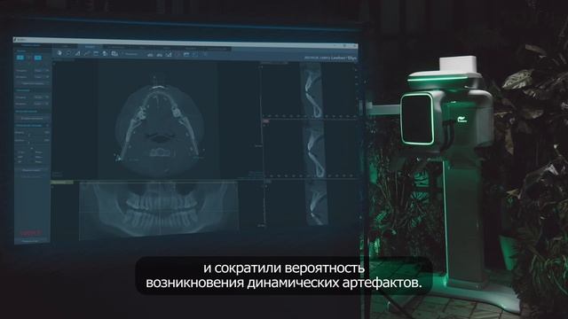 Компьютерный томограф Green 16 - безопасная рентгенодиагностика челюстно-лицевой области.