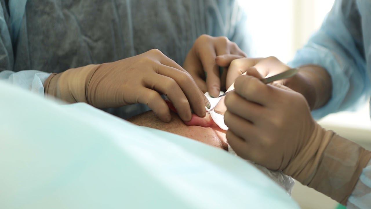 Отопластика. Хирург - Гуляев А.В. Часть 1.